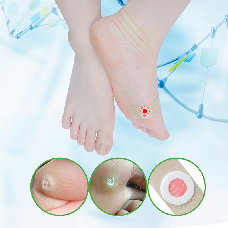 Buy Foot Corn Removal Plaster Thorn Patch Feet Callus Remove Pain ...