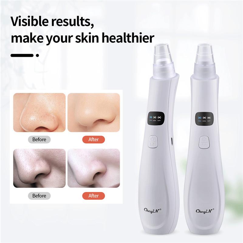 Buy CkeyiN Blackhead Vacuum Cleaner Pore Remover Rechargeable Acne ...