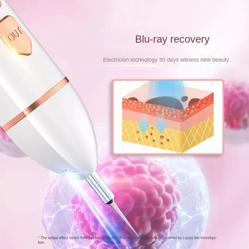 Buy Mole Removal Pen Freckle Removing Pen Painless Mole Removal ...