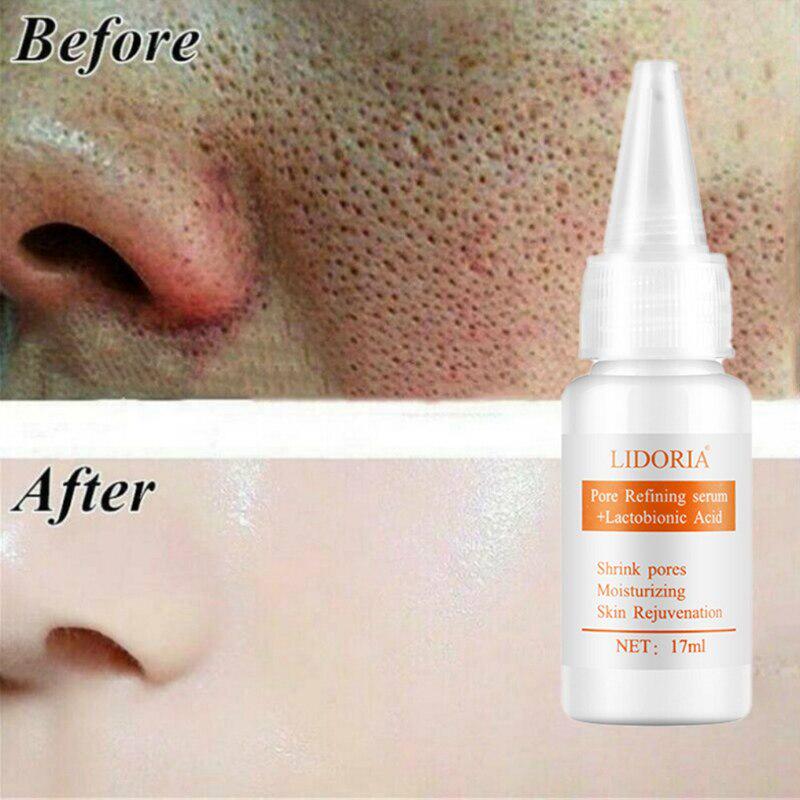 20ml Pore Refining Essence Moisturizing Soothing Invisible Pores Serum ...