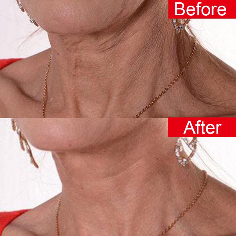 Buy Reusable Anti Wrinkle Neck Pad Silicon Transparent Anti Microgroove ...