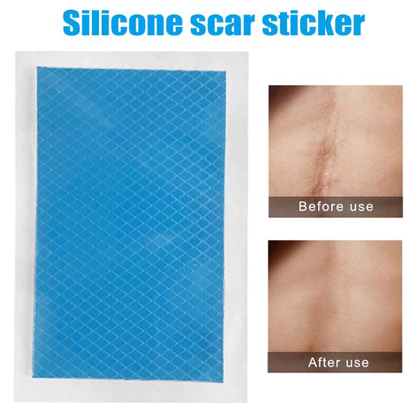 Buy Silicone Scar Therapy Sticker Remove Trauma Burn Silicon Patch ...
