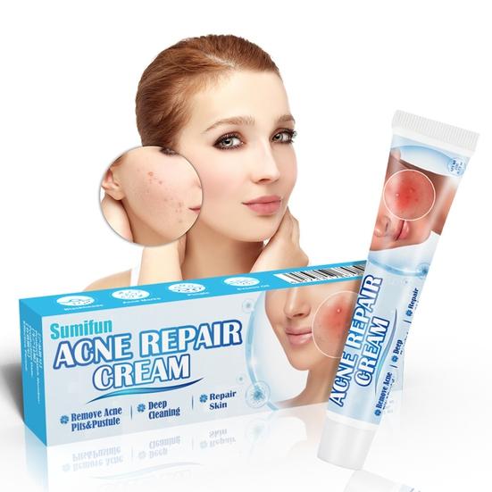 Buy Convenient Skin Cream Safe Easy to Absorb Mini Acne Scar Removal at ...