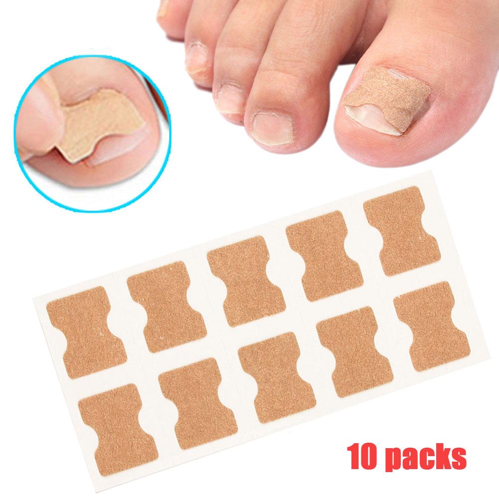 Buy Nail Correction Sticker Ingrown Toenail Corrector Stickers ...