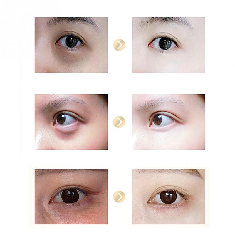 Buy Miss VIvi Anti Aging Eye Cream Eye Skin Care Cream Remove Eye Bag ...