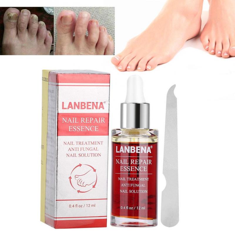 Buy 12 Ml Natural Powerful Nail Repair Anti-Fungus Nail Treatment ...