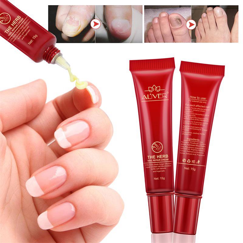 Nail Repair Cream Nourishing Herb Fingernail Care Treatment Striking ...