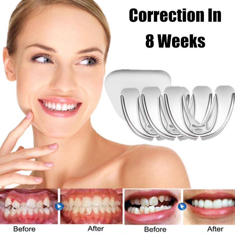 Buy 3pcs/set Tooth Adults Dental Orthodontic Appliance Trainer 3 Phases ...