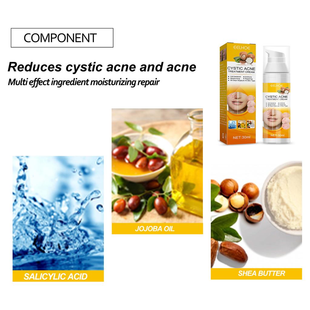 Cheap EELHOE Herbal Acne Removal Face Cream Oil Control Anti-Acne Gel Treatment Acne Mark Skin ...