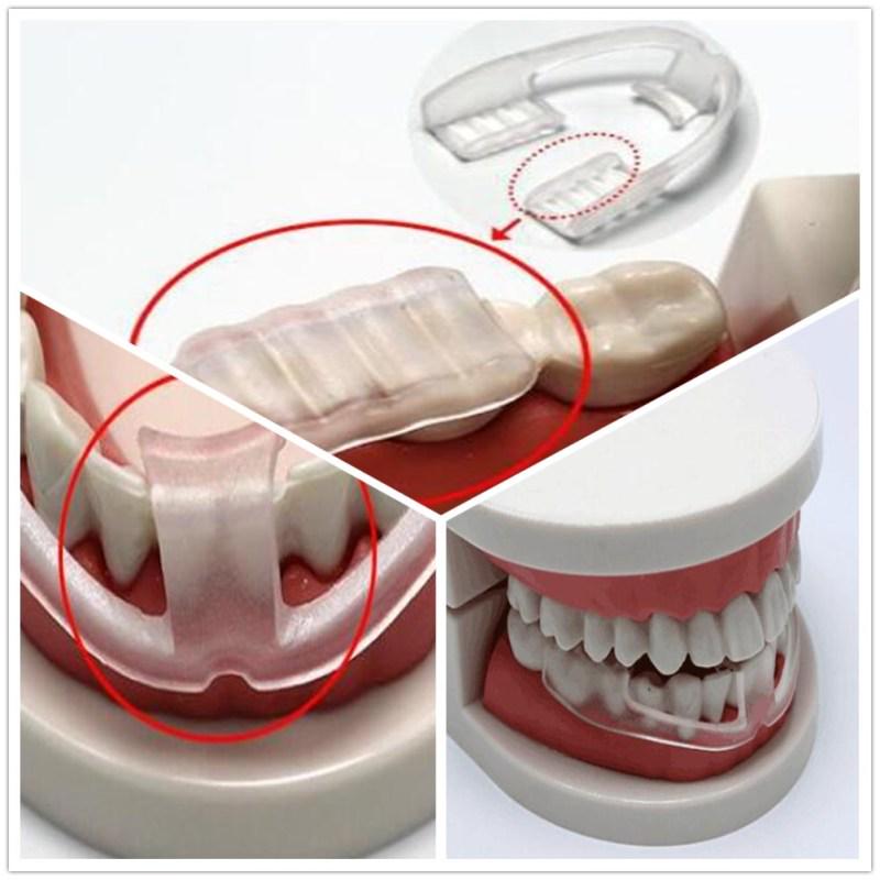 Buy Teeth Grinding Socket Beauty Dental Mouth Guard Bruxism Stop ...
