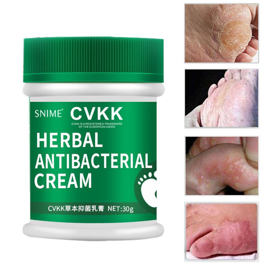 Satın alın 30ml Anti Bacterial Cream Athlete's Foot Fungal Infections ...