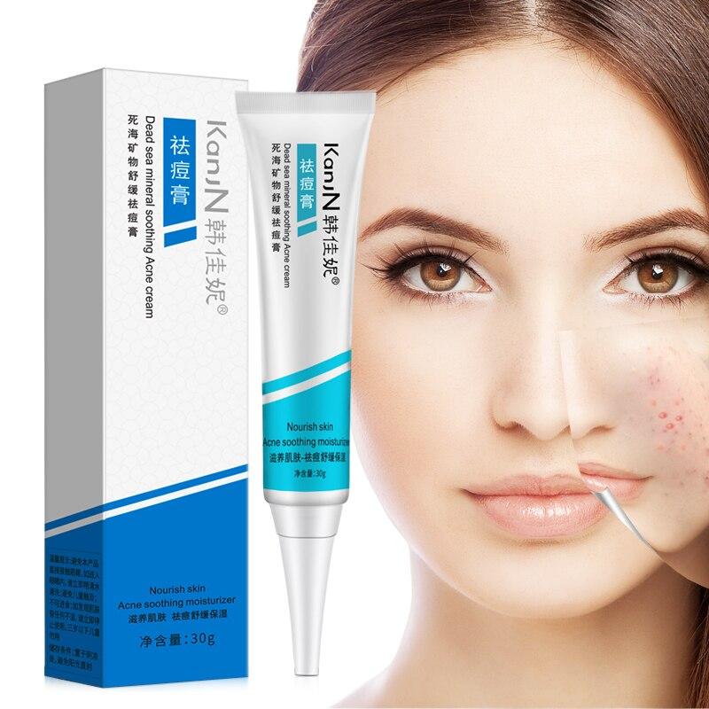 Buy Acne Treatment Face Cream Anti Acne Scar Removal Pimple Blackhead ...