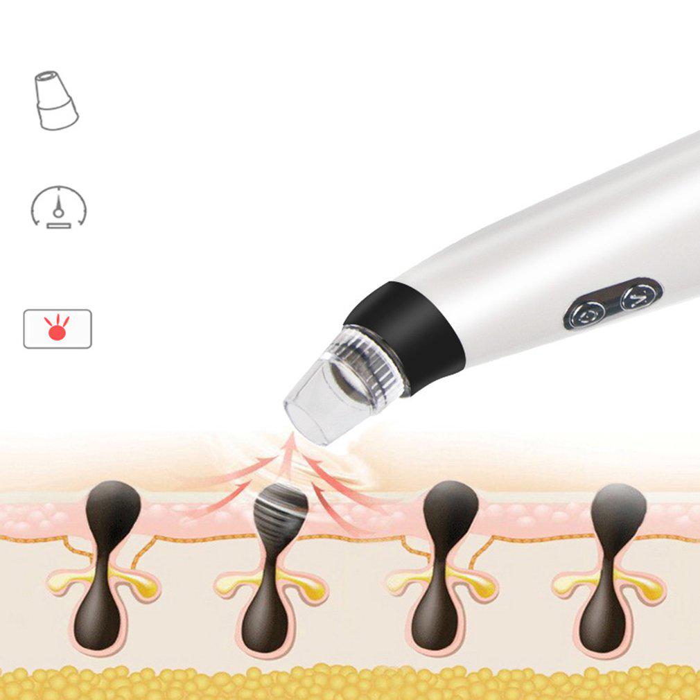 Buy Electric Micro Crystal Blackhead Instrument Home Artifact Massage ...