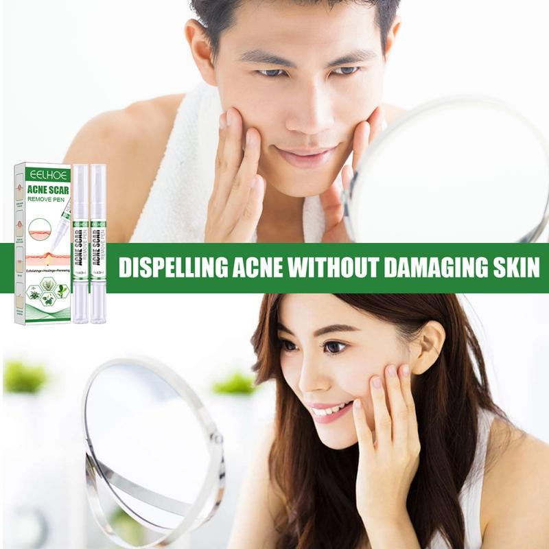 Buy Acne Pen for Acne Prone Sensitive Skin Natural Blend Acne Treatment ...