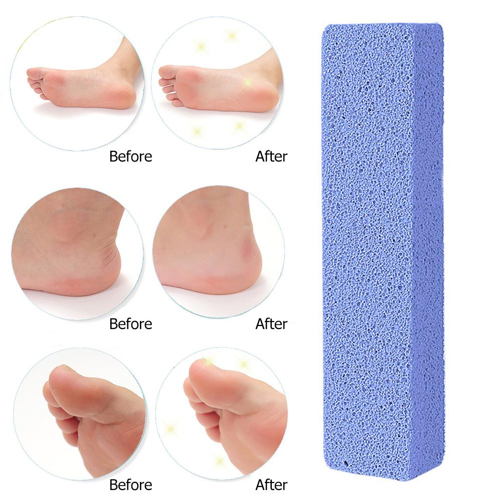 Buy Foot Plate Long Pumice Stone Dead Skin Callus Exfoliate Pedicure ...