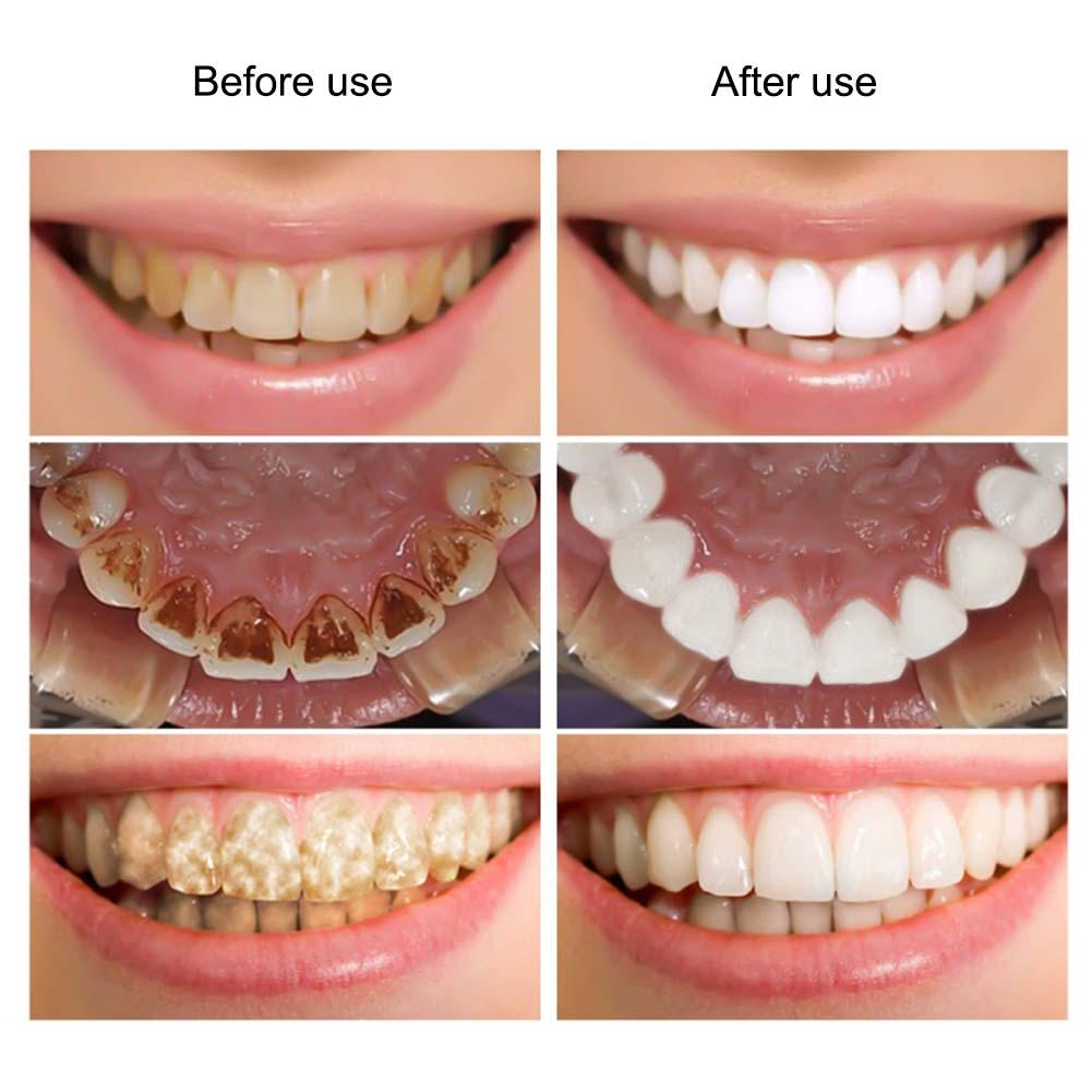 Buy Natural Teeth Whitening Powder Tooth Brushing Powder Teeth Whitener ...