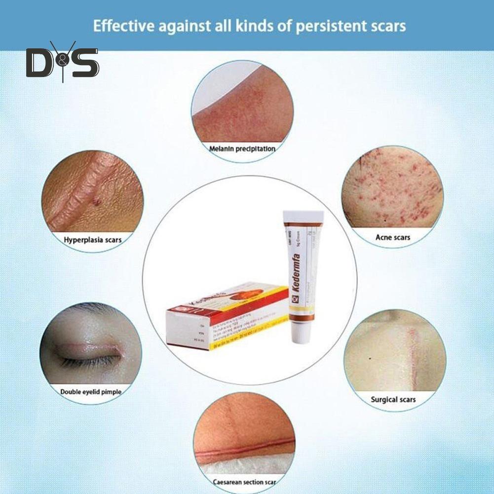 Buy Tendre Poison Snake Oil Ointment Remove Scar Cream Skin Nourishment ...