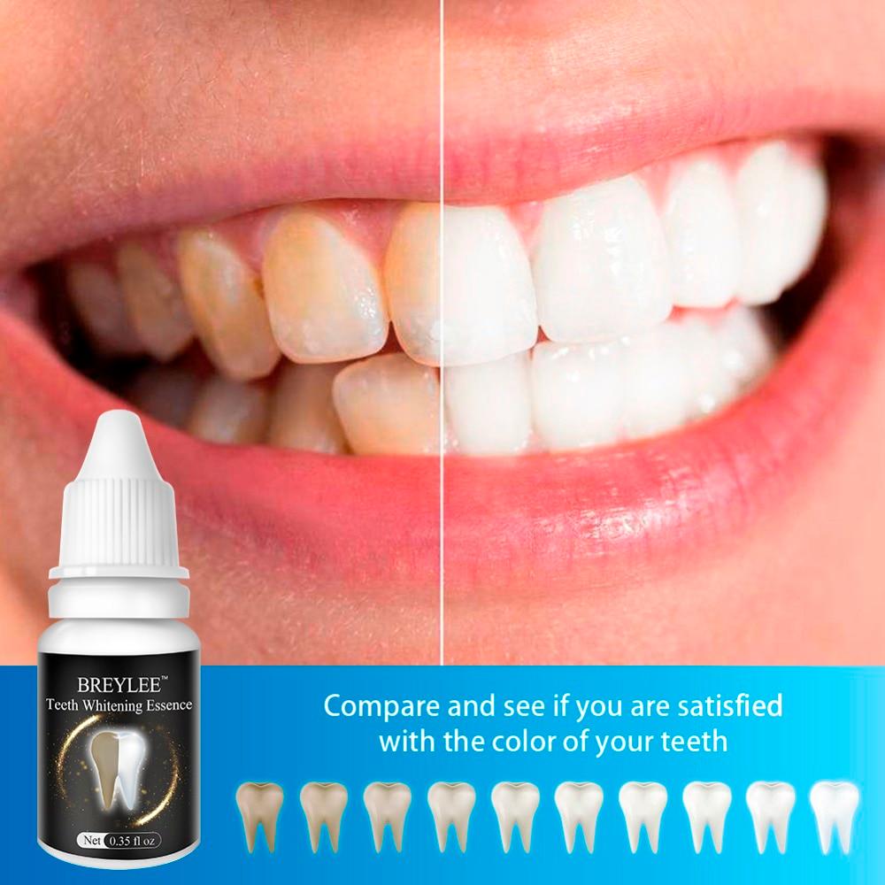 Buy 1 Bottle 10 Ml Teeth Whitening Essence Liquid Mouth Cleaning Tools ...