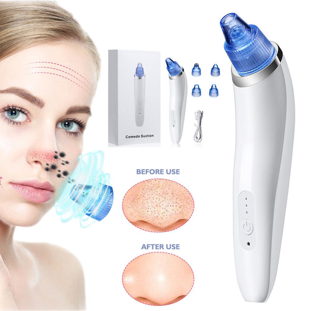 Buy Electronic Blackhead Remover Vacuum Suction Facial Acne Pore ...