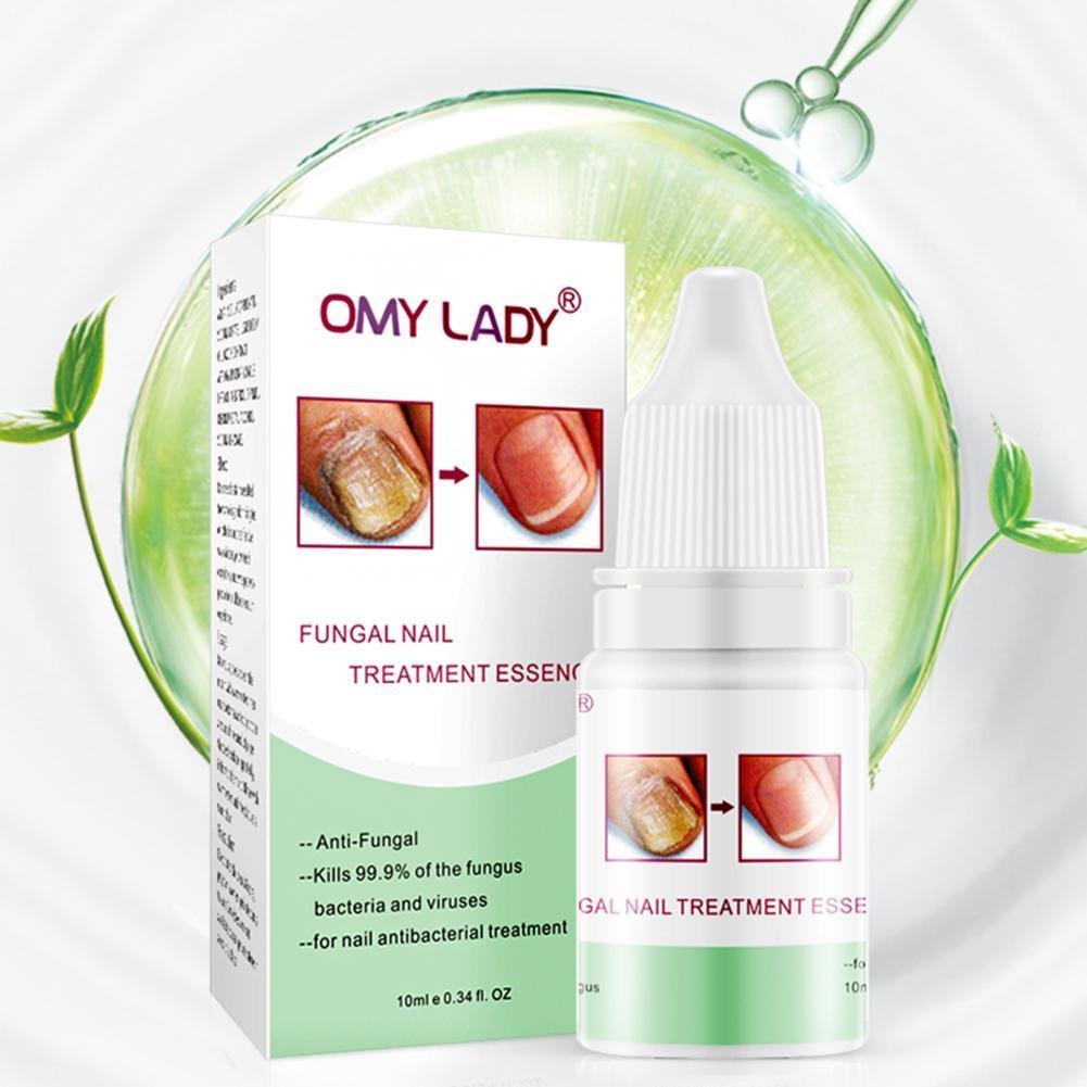 Buy 10ml OMY LADY Fungal Nail Treatment Essence Foot Nail Anti ...