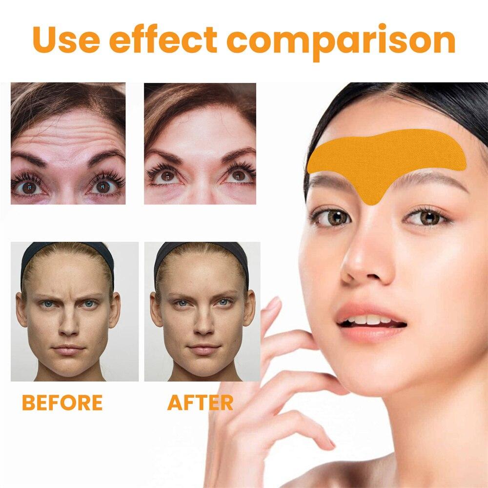 Buy 10Pcs/Box Fox Eyes Forehead Wrinkle Patch Lighten Smooth Forehead ...