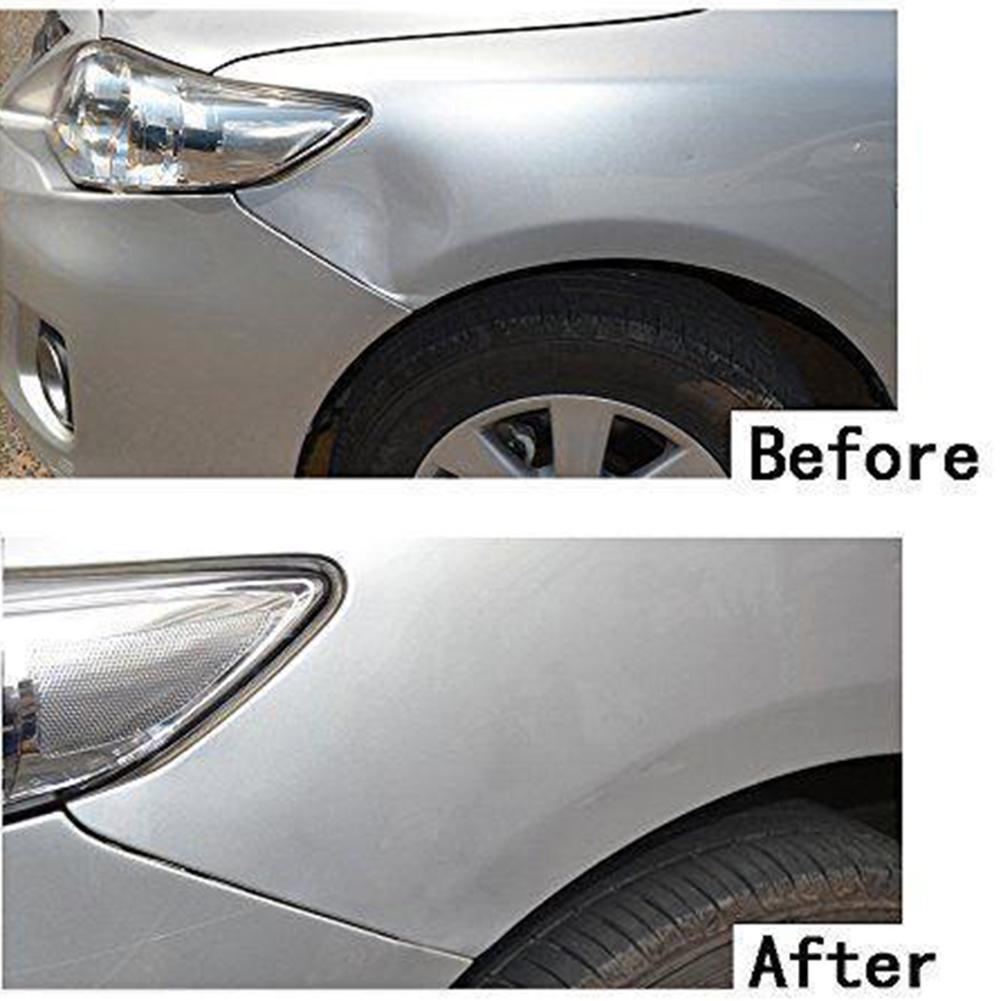 Pops a Dent Bridge Dent Puller Tool Kit Car Dent Paintless Repair PDR ...