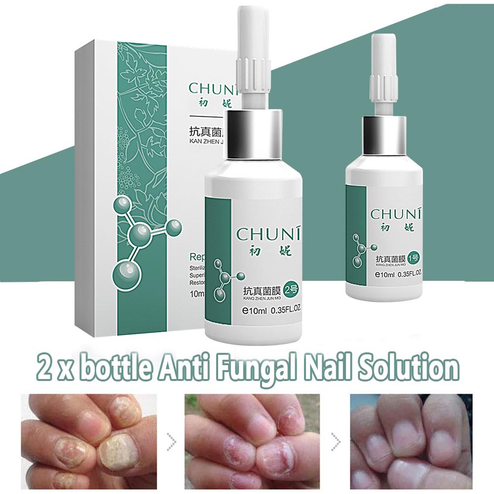 Buy Effective Fungus Stop, Fungus Treatment, Anti Fungus Nail Treatment ...