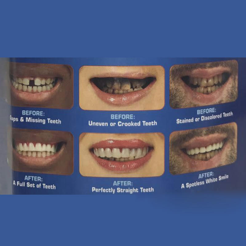 Buy Perfect Smile Instant Smile Comfort Fit Flex Teeth Top Silicone ...