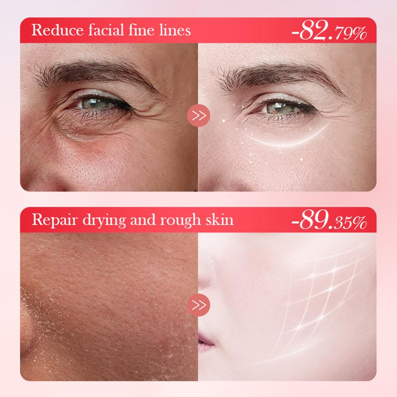 Goji Berry Anti-Wrinkle Firming and Whitening 6-piece Anti-aging and ...
