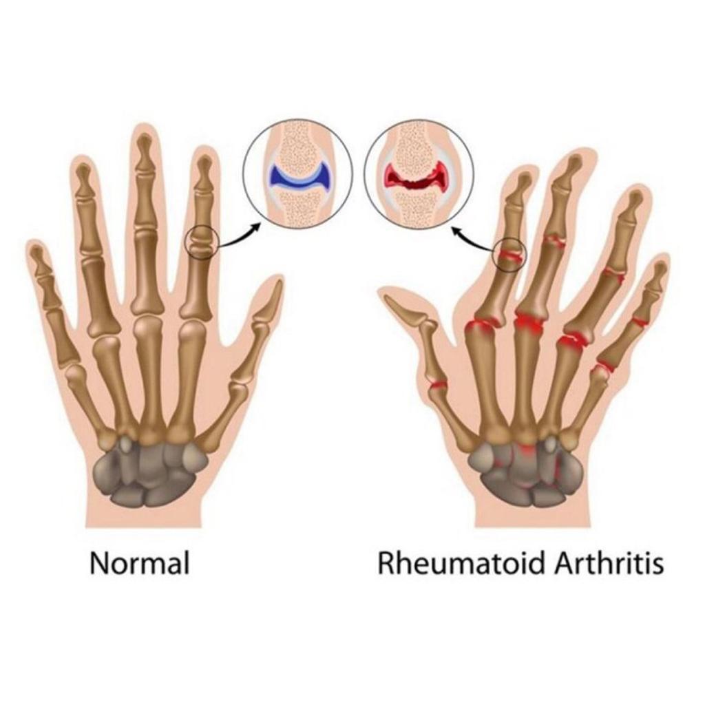 LLLD Copper Fiber Gloves Anti Arthritis Therapy Compression Half Finger ...