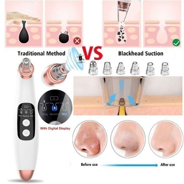 Buy Beauty Cleanser Machine Electric Blackhead Facial Zit Pore USB Spot ...