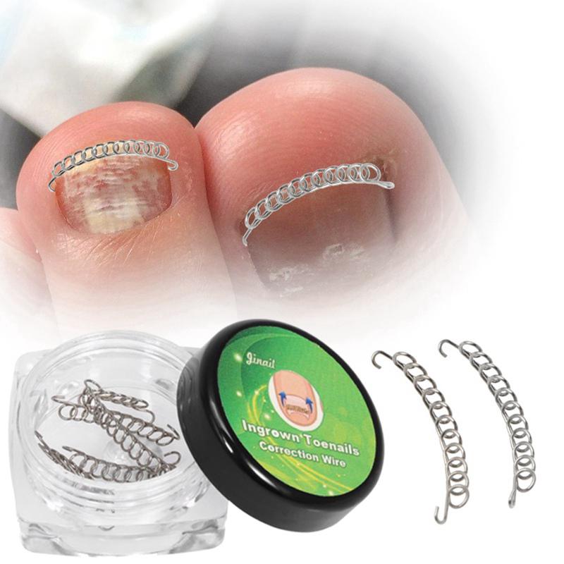 Buy 6PCS/Set Stainless Steel Nail Wire Ingrown Toe Nail Correction ...