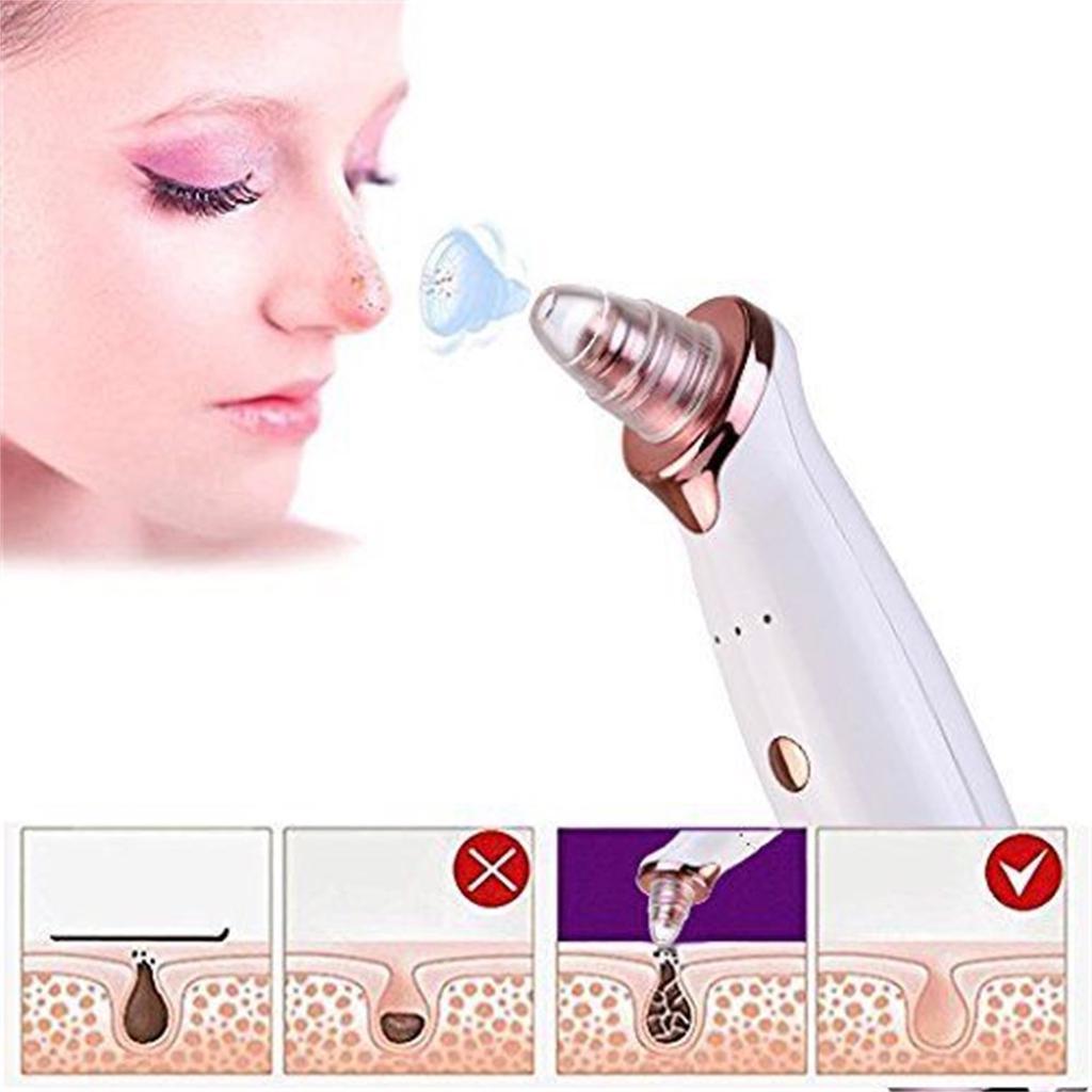 Skin Care Pore Acne Pimple Cleaner Vacuum Suction Blackhead Remover ...