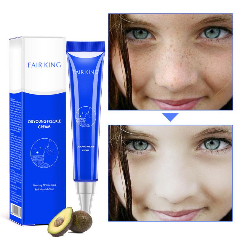 Buy Dark Spot Corrector Skin Whitening Fade Cream Lightening Blemish ...