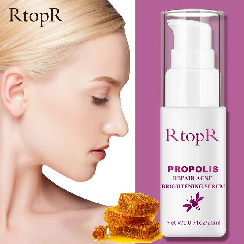 Buy RtopR Propolis Repair Acne Brightening Serum Acne Scar Spots ...