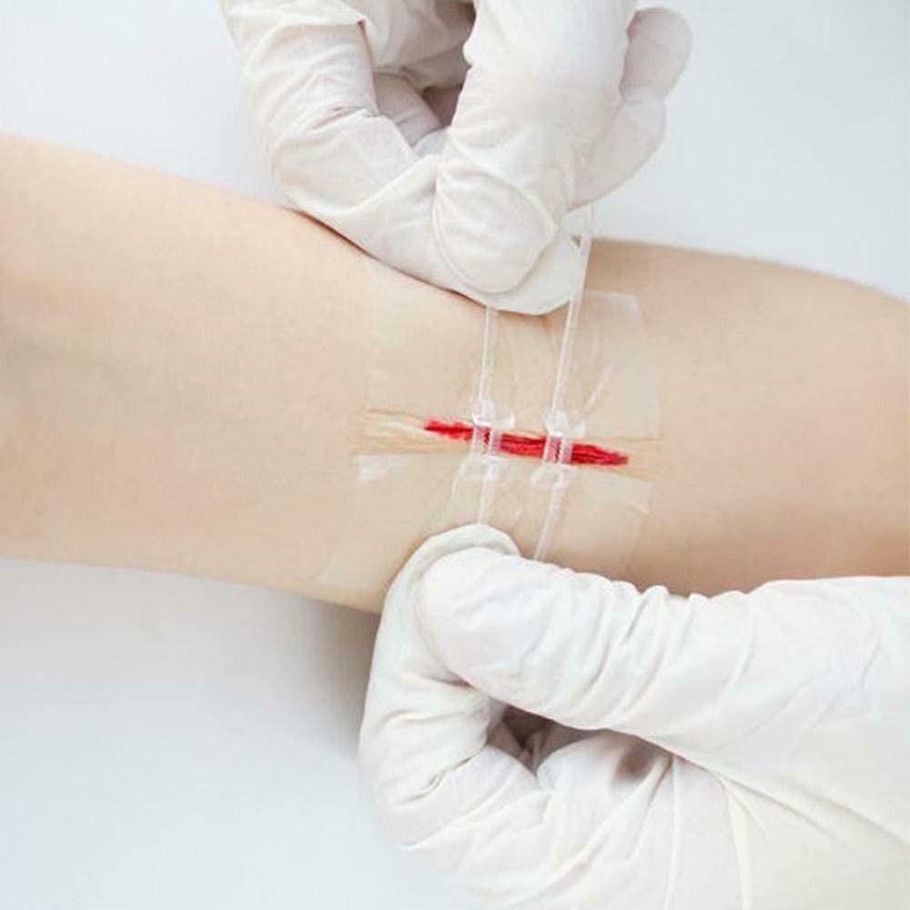 Buy Zipper Non-invasive Suture First Aid Kit Quick Suture Stop Bleeding ...