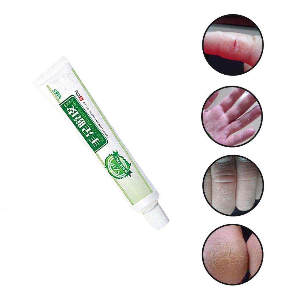 Hand Foot Crack Repair Cream Heel Crack Repair Anti - Dry Hands And ...