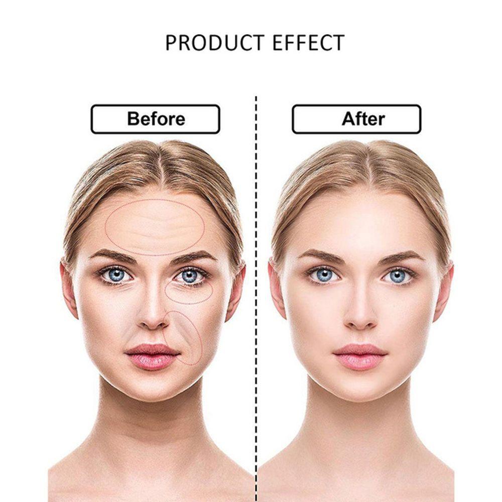 Buy Face Lines Forehead Lift Nasolabial Folds Facial Tape Anti-Wrinkle ...