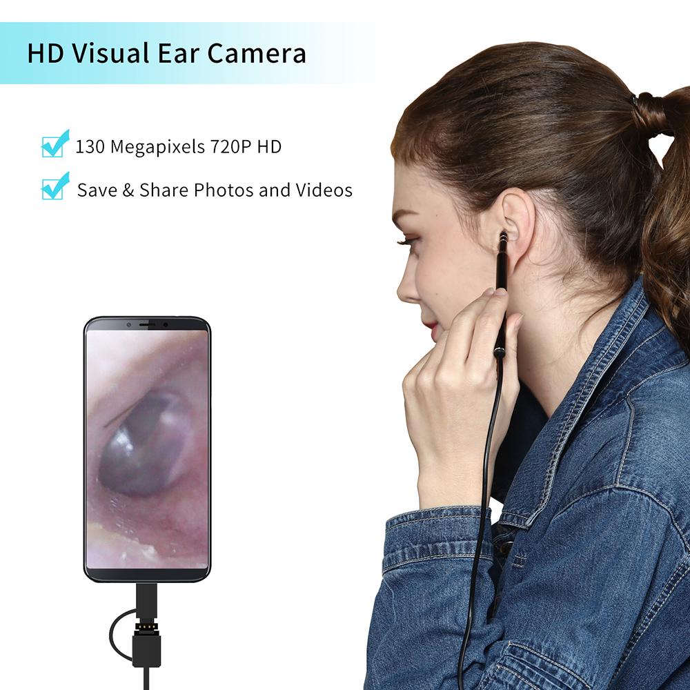 Buy Smart Visual Ear Otoscope, 720P USB Otoscope-Ear Scope Camera, Ear ...