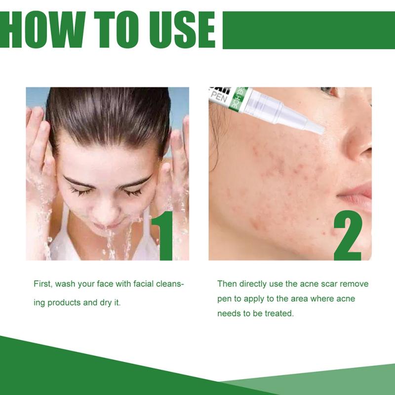 Buy Acne Pen for Acne Prone Sensitive Skin Natural Blend Acne Treatment ...