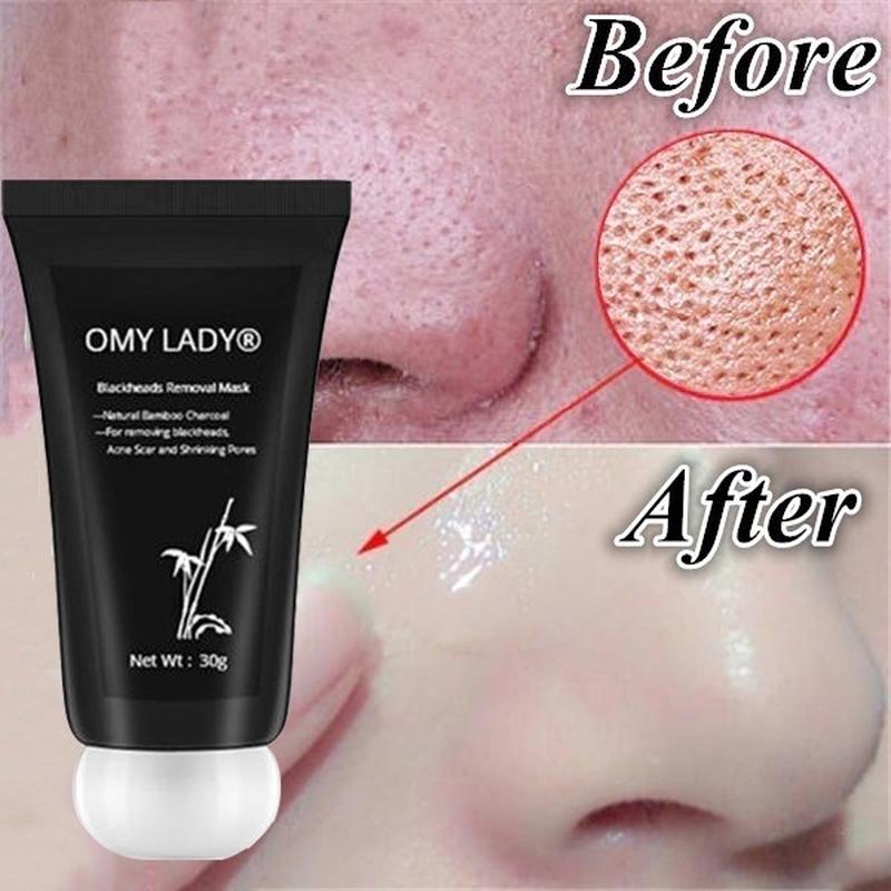 Buy 1 Pcs Blackhead Remover Nose Mask Pore Strip Black Mask Peeling ...