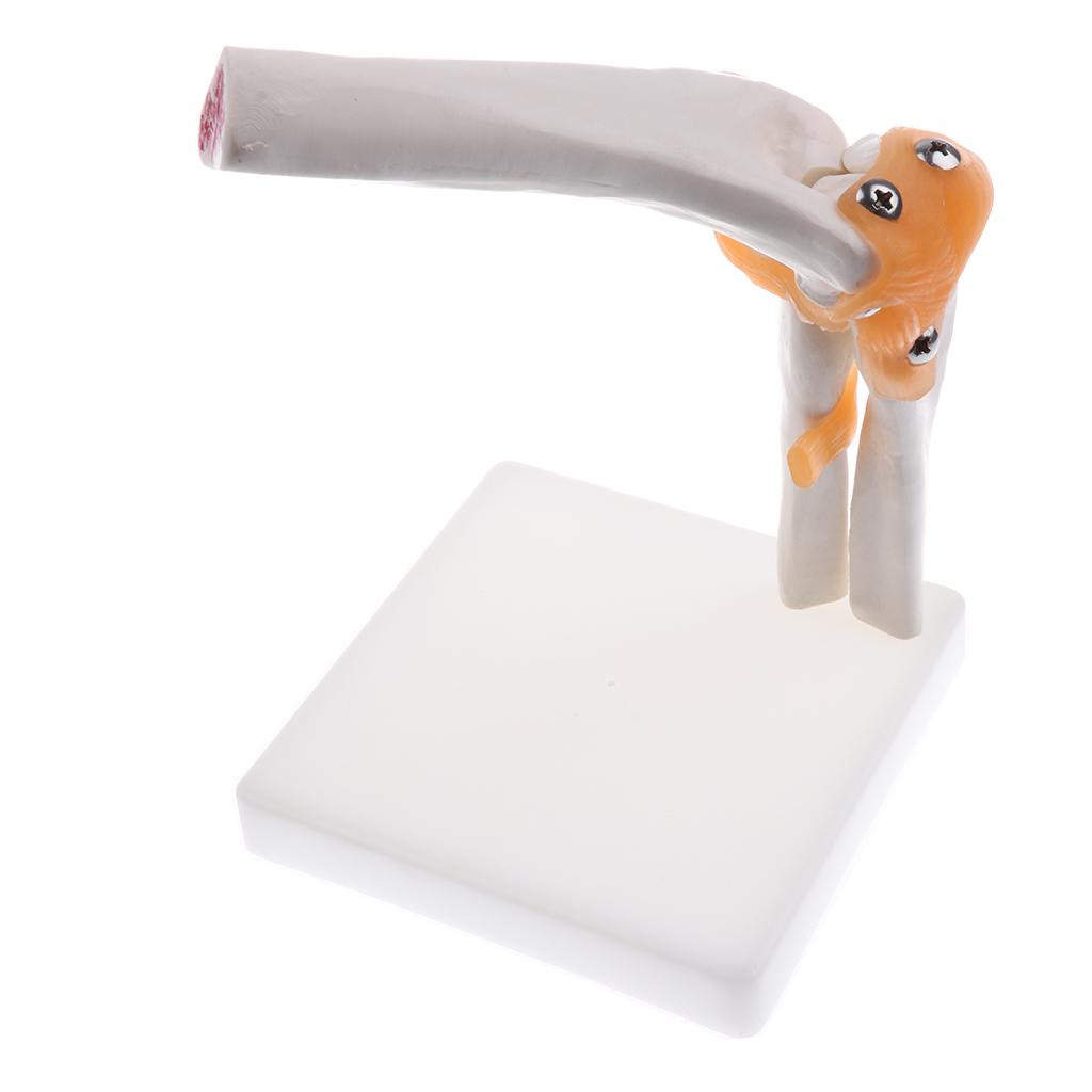 Buy 1:1 Lifesize Human Elbow Joint w/Ligament Anatomical Model Kits ...