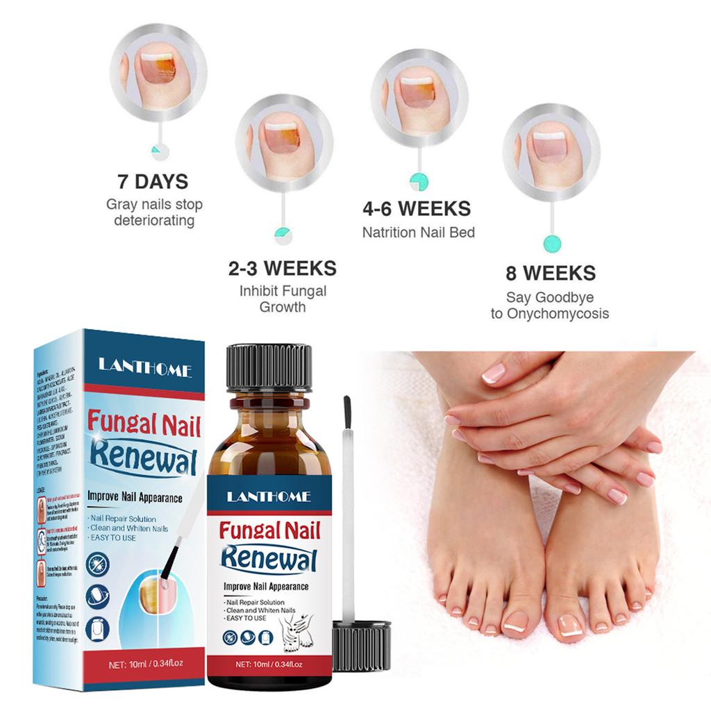Buy LANTHOME 10ml Fangal Nail Renewal Enhanced Nail Repair Solution ...