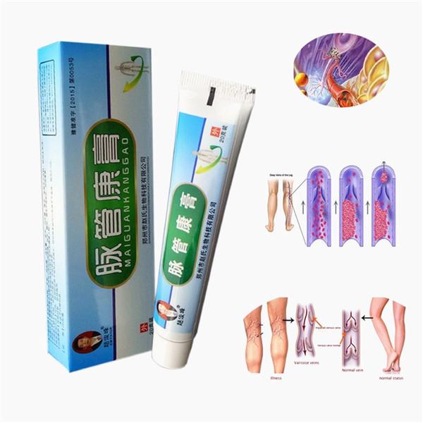 Buy Phlebitis Health Care Vasculitis Cream Varicose Veins Ointment ...