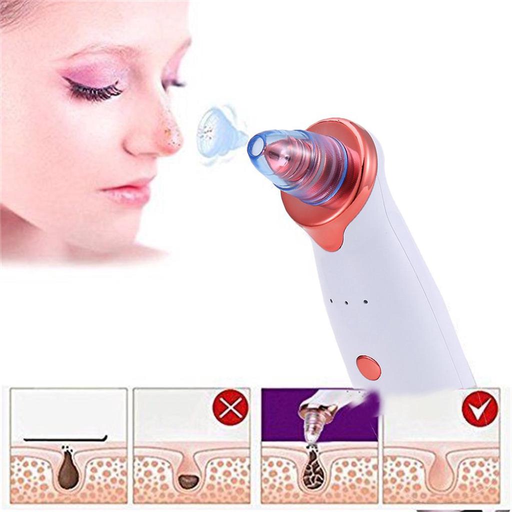 Buy Electric Facial Pore Cleaner Acne Blackhead Removal Machine USB ...