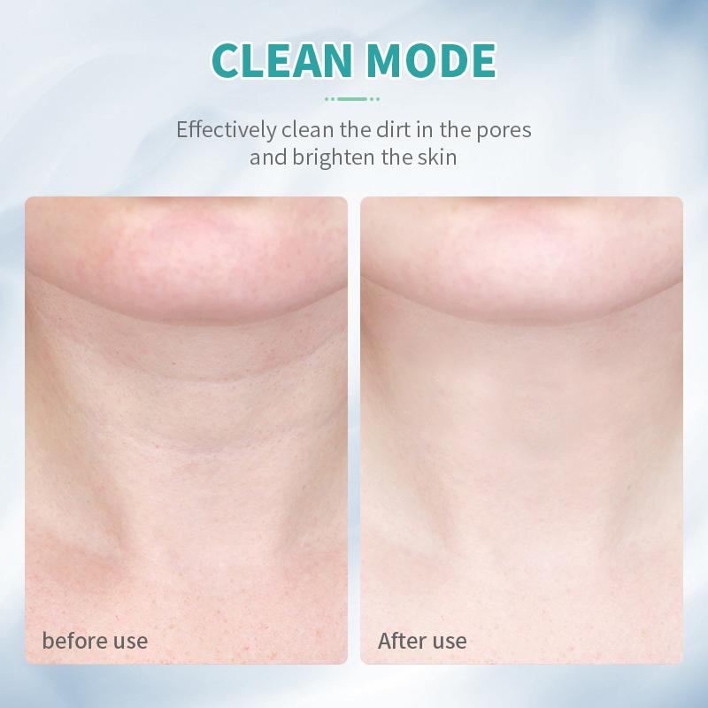 Cheap ANLAN Neck Face Beauty Device 3 Colors LED Photon Therapy Skin ...