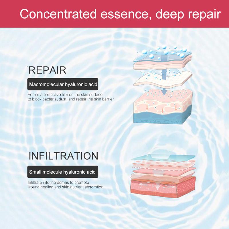 EGF Repair Cold Compress To Prevent Allergy Moisturizing Anti-Aging ...