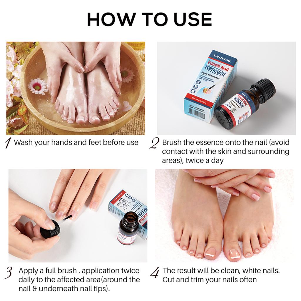 Buy LANTHOME 10ml Fangal Nail Renewal Enhanced Nail Repair Solution ...