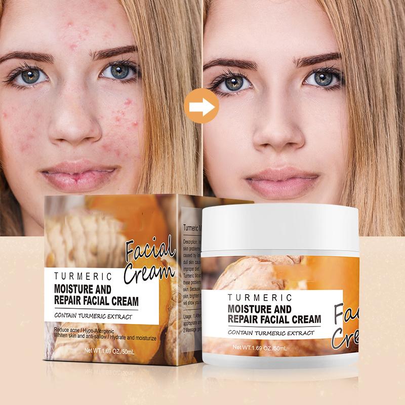 Buy 50ml Turmeric Facial Skin Repair Cream Acne Treatment Face ...