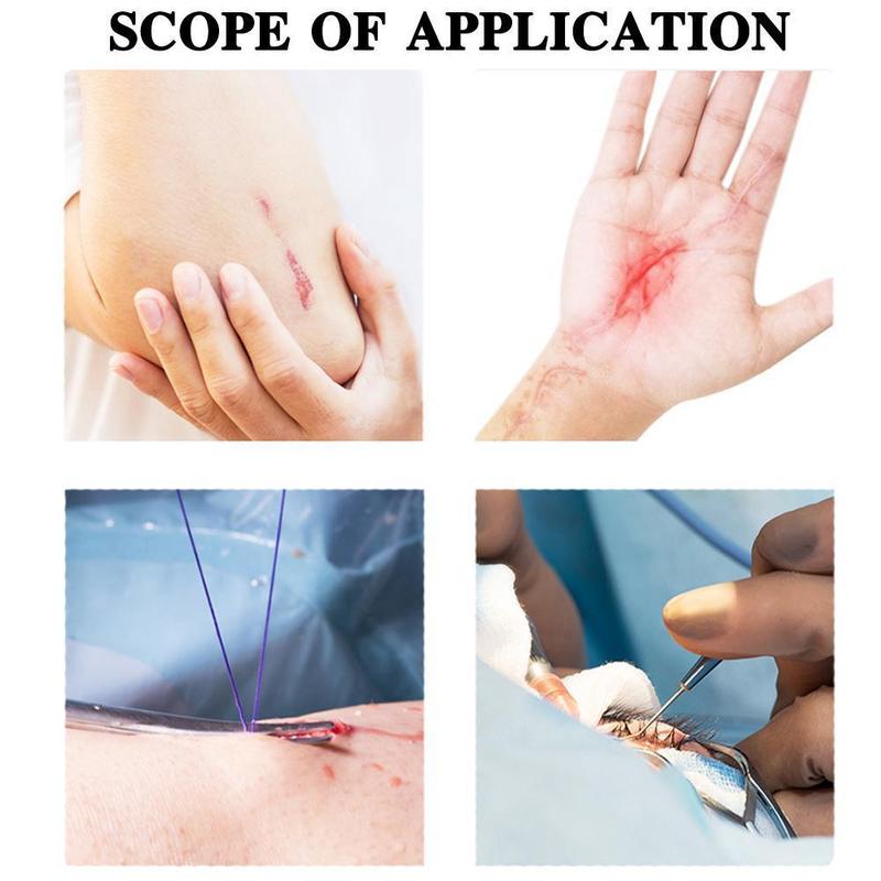 Buy Bandage Band Aid Zip Stitches Zip Tie Wound Closure 2021 Adhesive ...